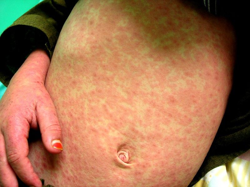 Omicron Variant Is Second Most Contagious Virus On Earth What s Omicron Variant Is Second Most Contagious Virus On Earth What s