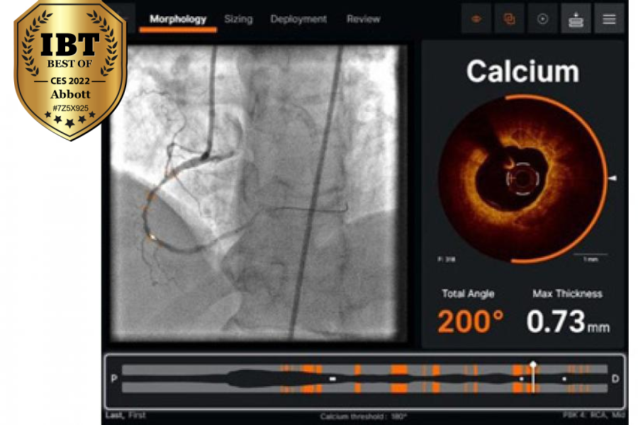 CES 2022: Ultreon 1.0 Software Revolutionizes Blood Clot Imaging | IBTimes